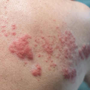 Common Skin Conditions - White Rock Dermatology | Skin Treatments, TX